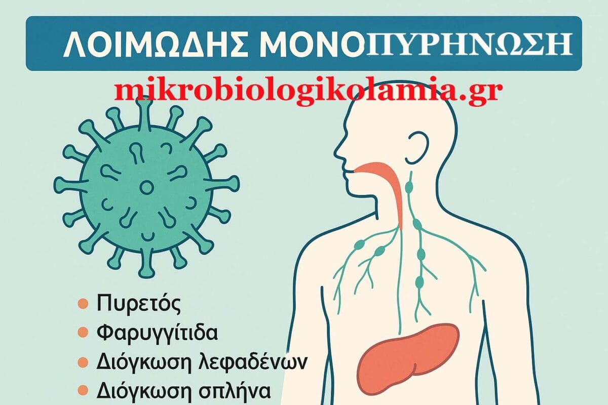Λοιμώδης Μονοπυρήνωση: Συμπτώματα, Μετάδοση & Αντιμετώπιση ...