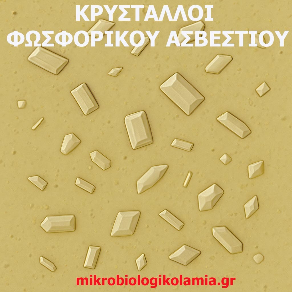 Κρύσταλλοι φωσφορικού ασβεστίου στα ούρα – Αίτια, pH, θεραπεία ...
