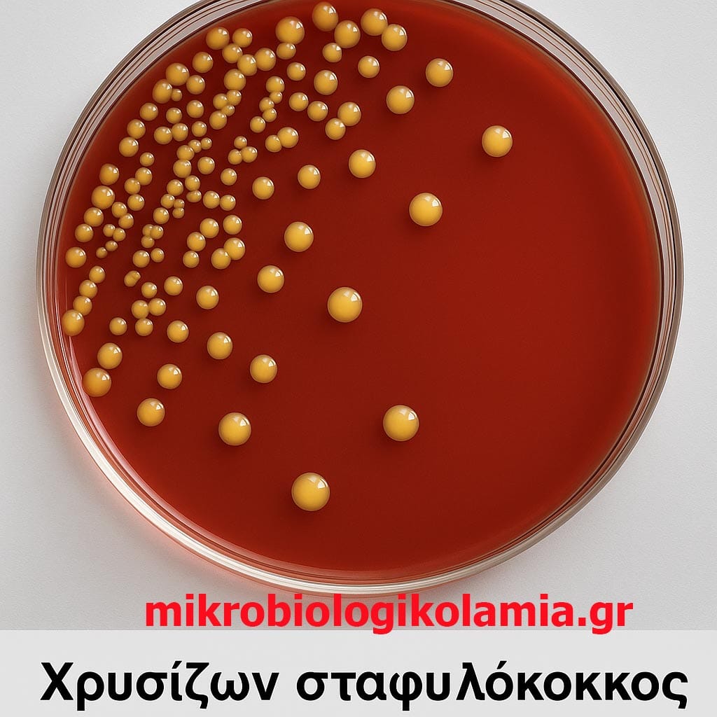Χρυσίζων Σταφυλόκοκκος (Staphylococcus aureus) – Συμπτώματα, Διάγνωση ...
